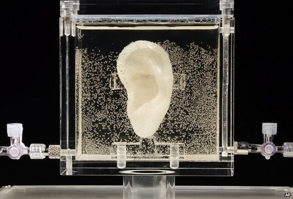 Vincent van Gogh 'live ear' on display - BBC News
