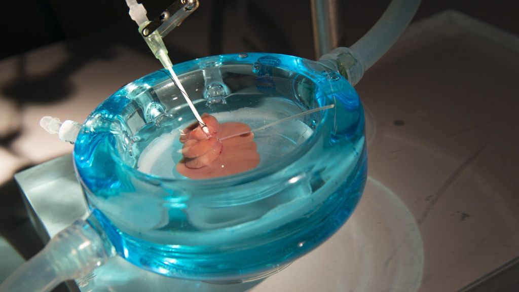Organ transplants: 'Supercooling' keeps organs fresh - BBC News