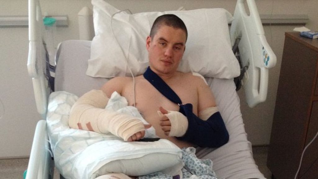 Injured cyclist: 'I survived being run over by a lorry' - BBC News