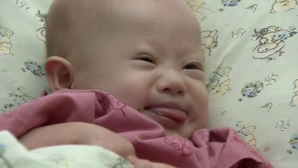 Surrogate baby Gammy 'improving', doctors say - BBC News