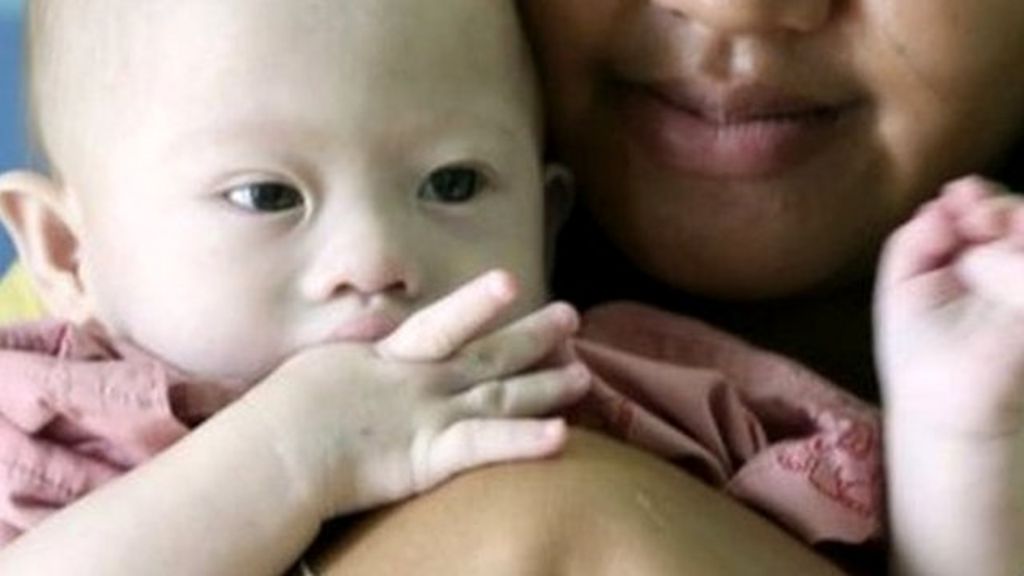 Baby Gammy case: Calls for clearer surrogacy rules - BBC News