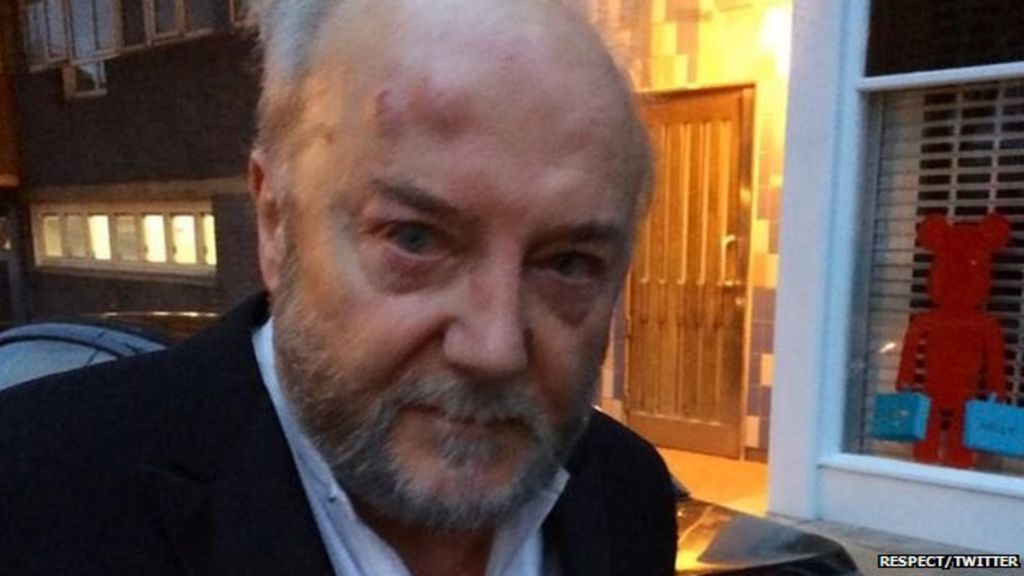 George Galloway taken to hospital after street attack - BBC News