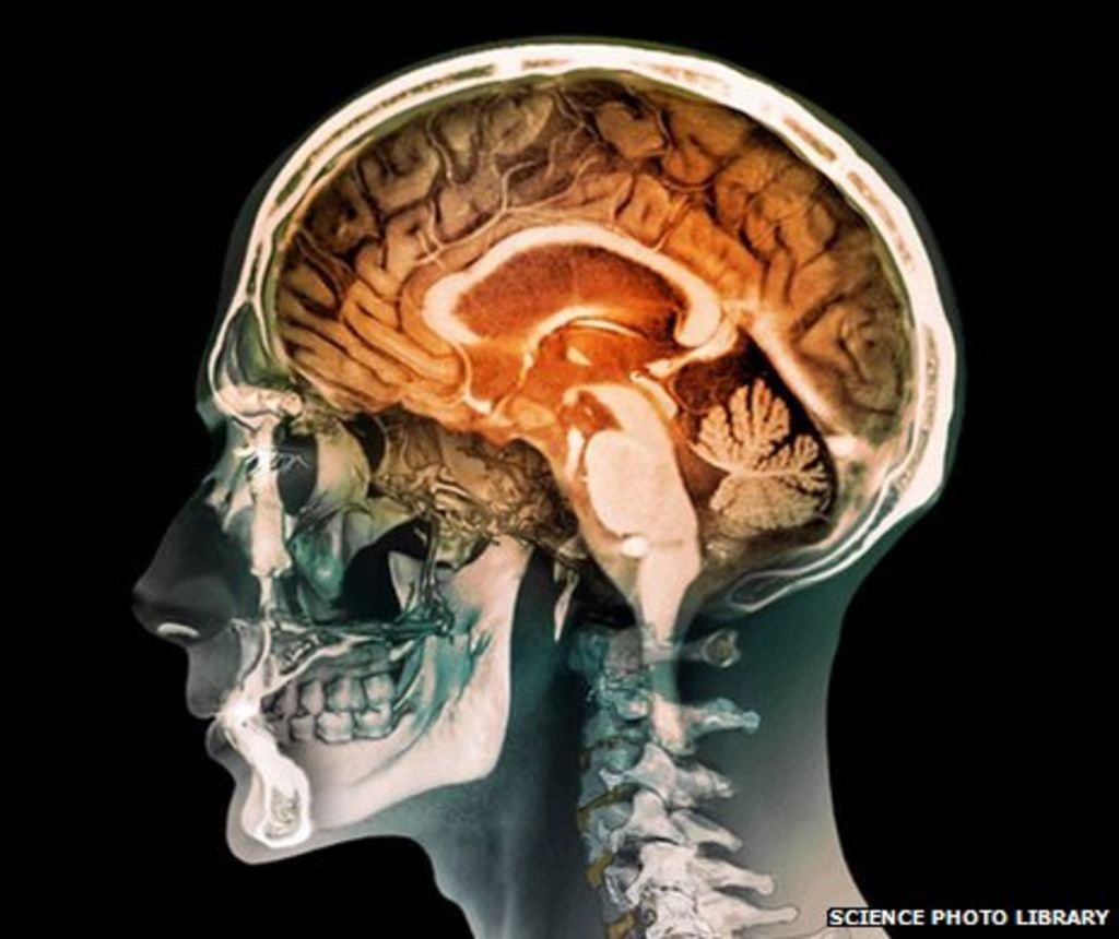 Is your brain male or female? - BBC News