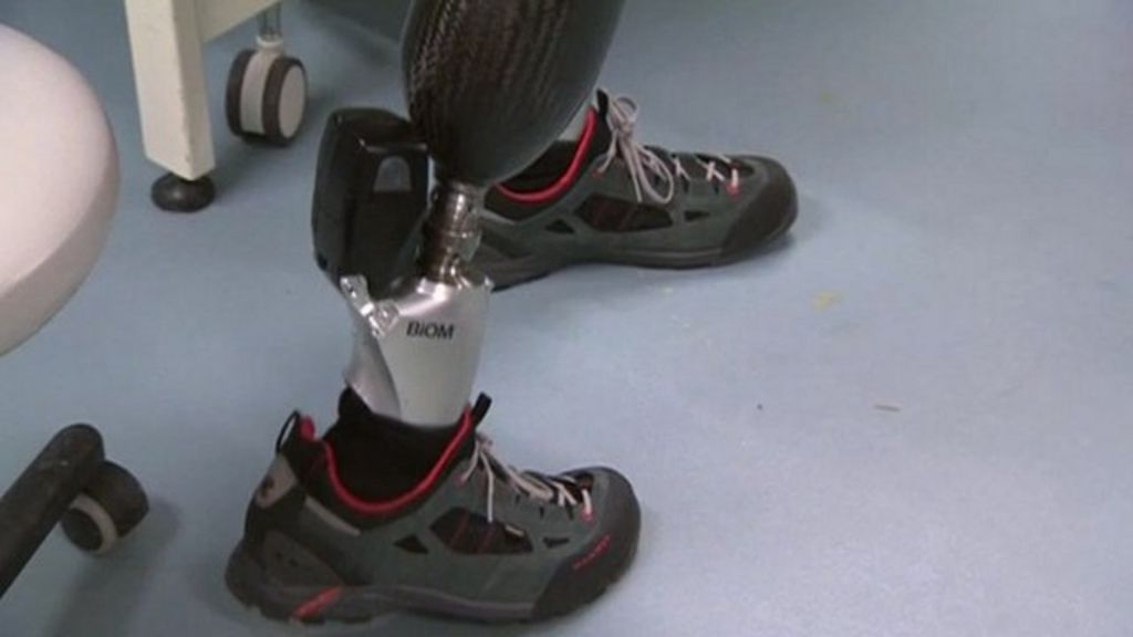 New research to help people re-grow lost arms and legs - BBC Newsround