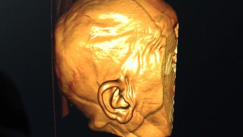 Free digital autopsies introduced in Sandwell from November - BBC News