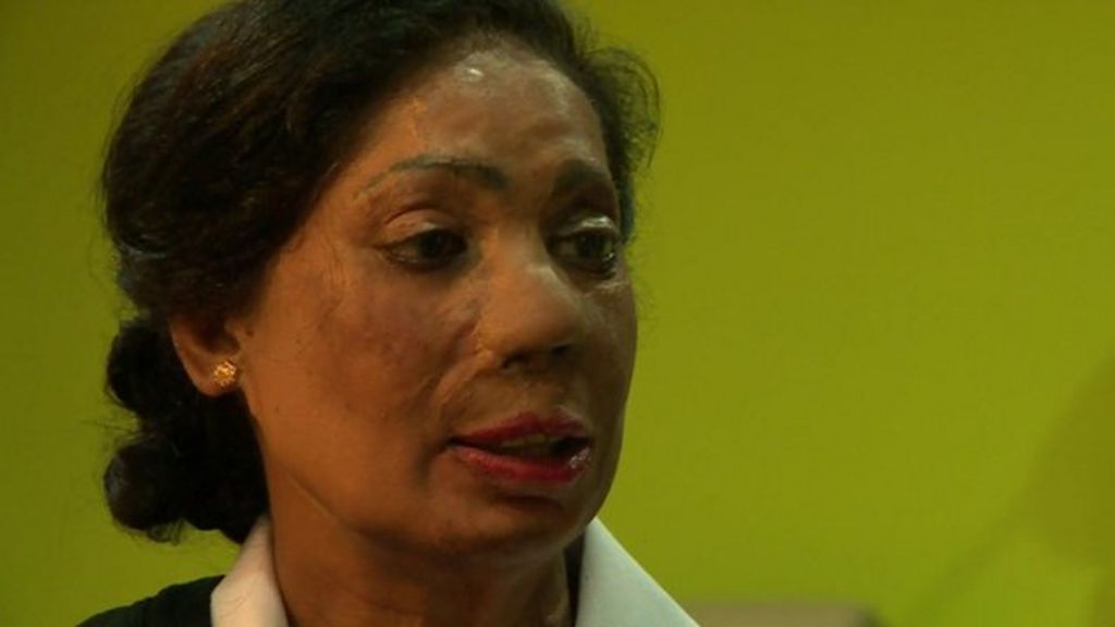 100 Women: Beauty salon provides refuge for acid attack victims - BBC News