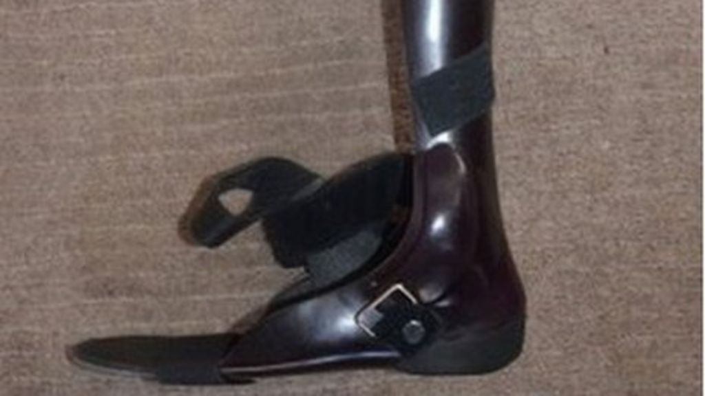 Leg splints stolen from Skegby cerebral palsy teenager - BBC News