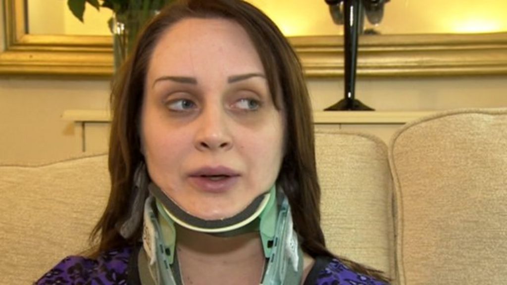 Woman raises funds for urgent neck operation in USA - BBC News