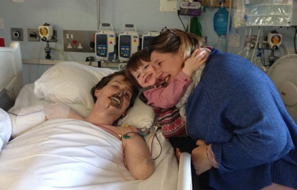 'The year I lost my limbs was the most brilliant of my life' - BBC News