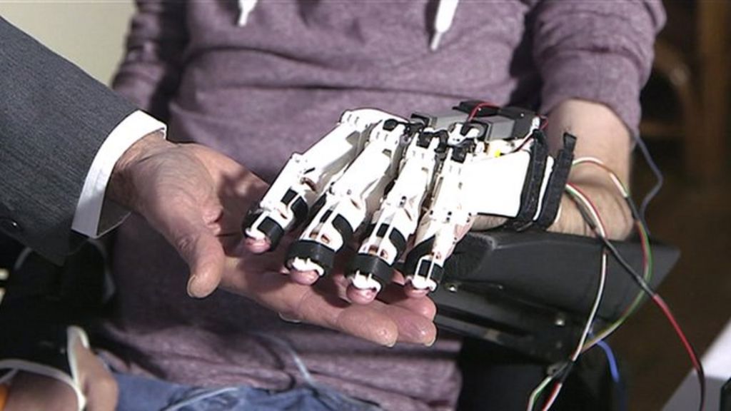 Bionic breakthrough for paralysed patients - BBC News