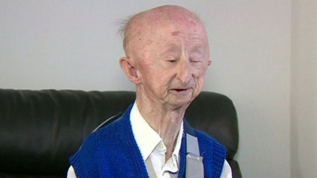 Alan Barnes: Disabled mugging victim appeal fund rises - BBC News