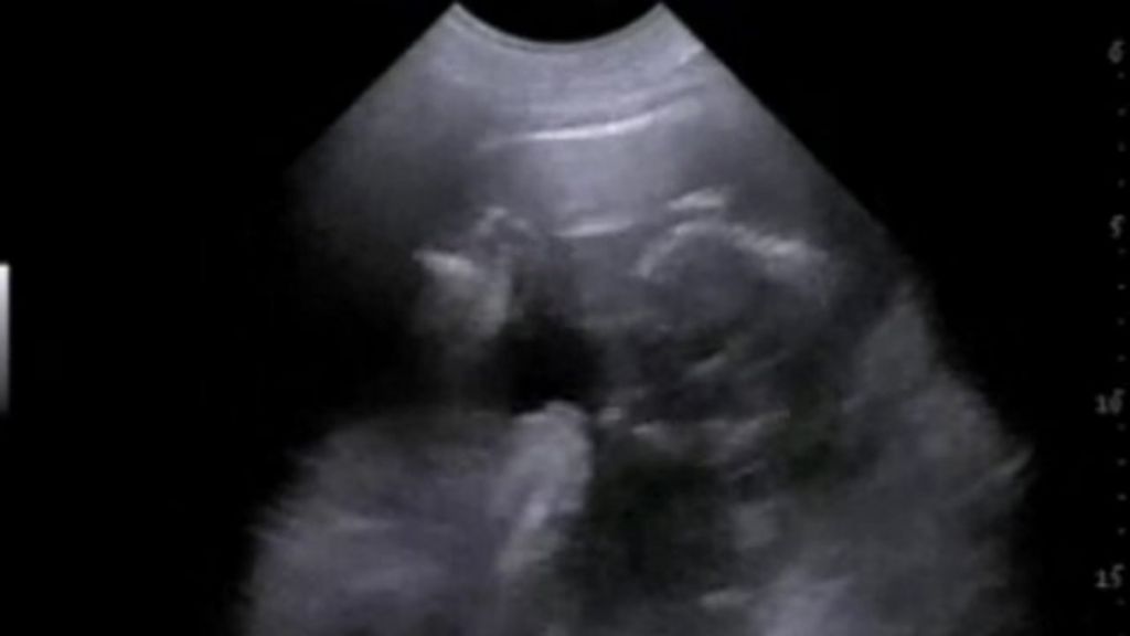 Pygmy hippopotamus baby 'runs' in the womb - BBC News