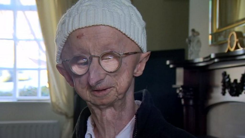 Mugging victim Alan Barnes 'ready to move on' - BBC News