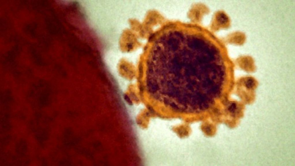 WHO issues disease-naming advice to avoid offence - BBC News