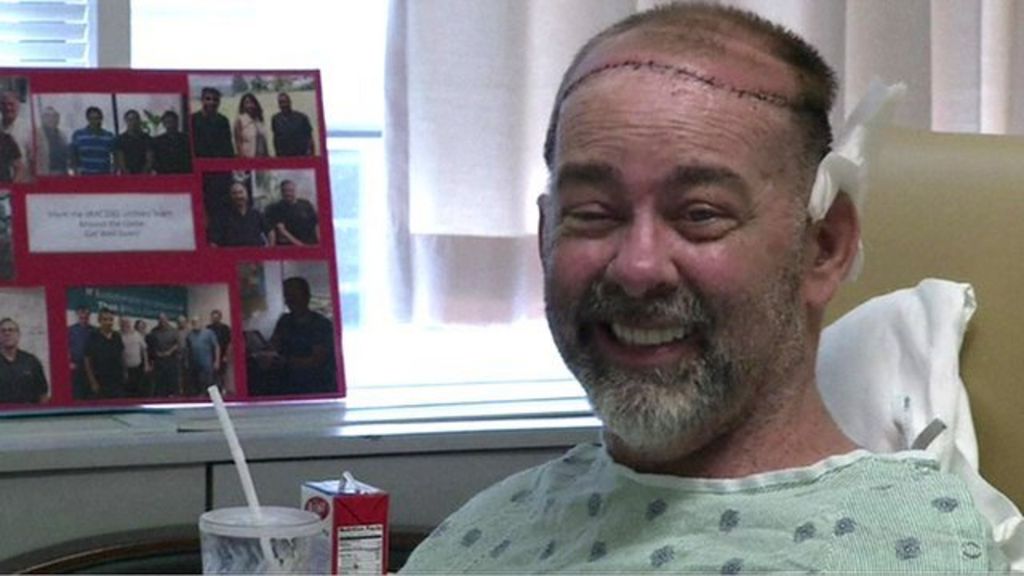 Texas man has world's first skull and scalp transplant - BBC News