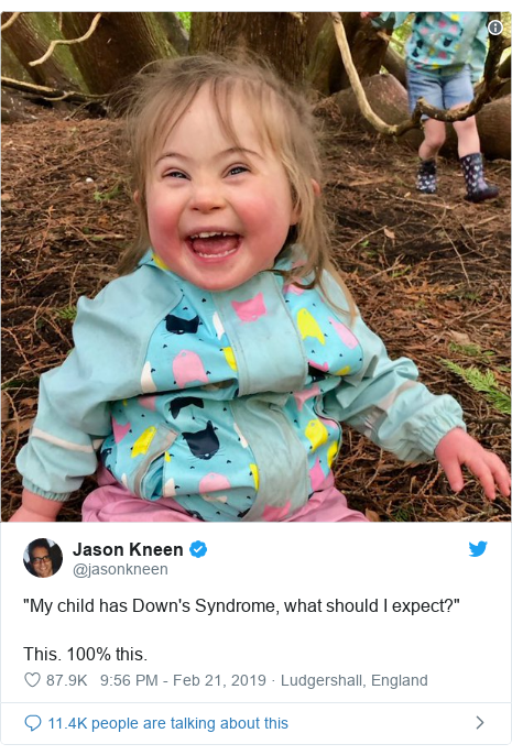 Dwayne 'The Rock' Johnson sends message to girl with Down's syndrome ...
