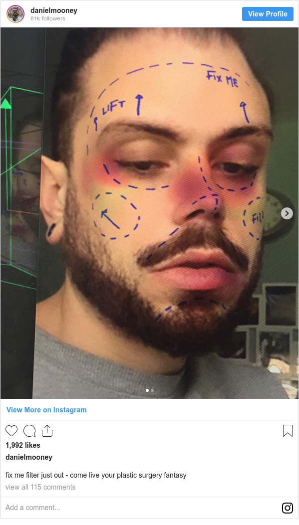 Instagram bans 'cosmetic surgery' filters - BBC News