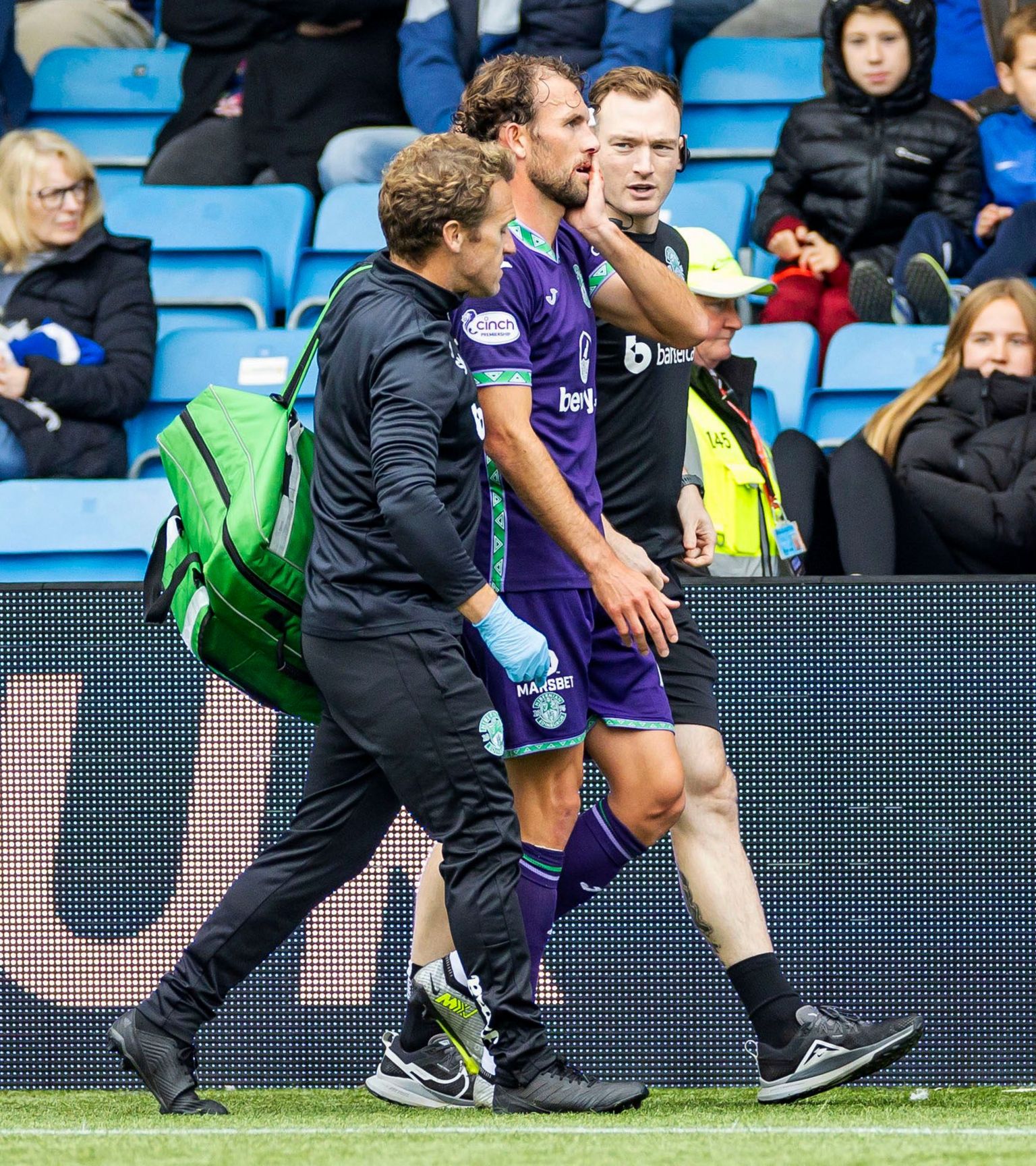 Doidge's eye was 'virtually hanging out' - BBC Sport