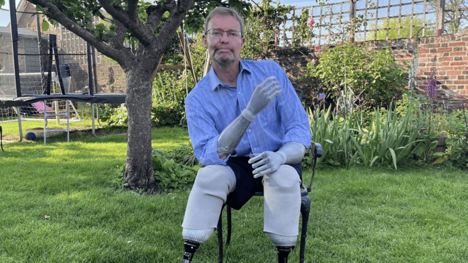 Newspaper headlines: 'Terror in the sky' and 'I've lost my hands and ...