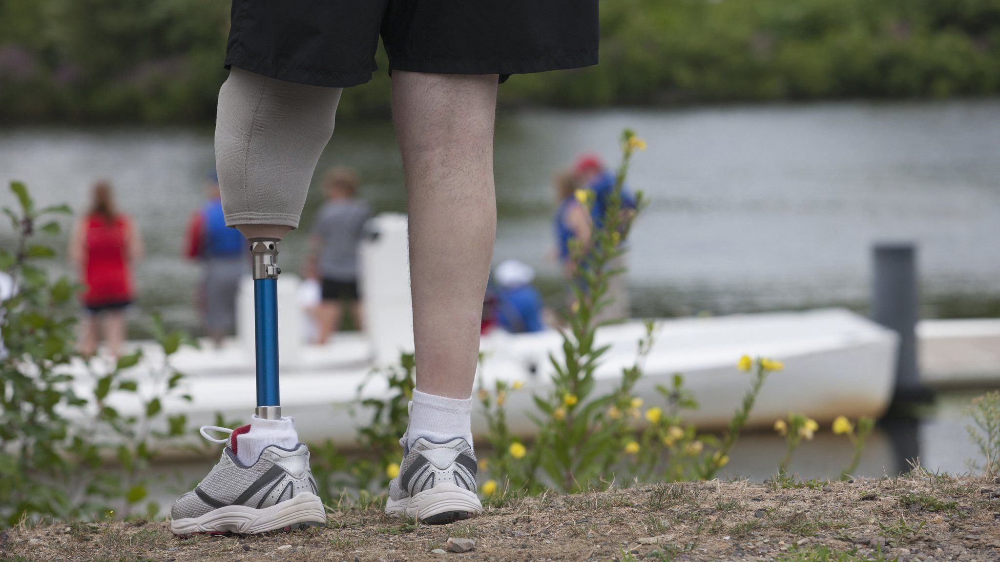 Man dies 18 months after 'enforced foot amputation' bid - BBC News