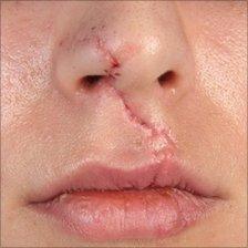 Woman scarred by glassing attack in Swindon nightclub - BBC News