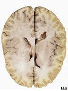 Karate punching power 'all in the brain' - BBC News