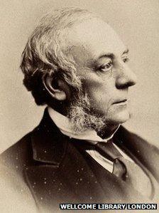 Joseph Lister's unknown operation uncovered - BBC News