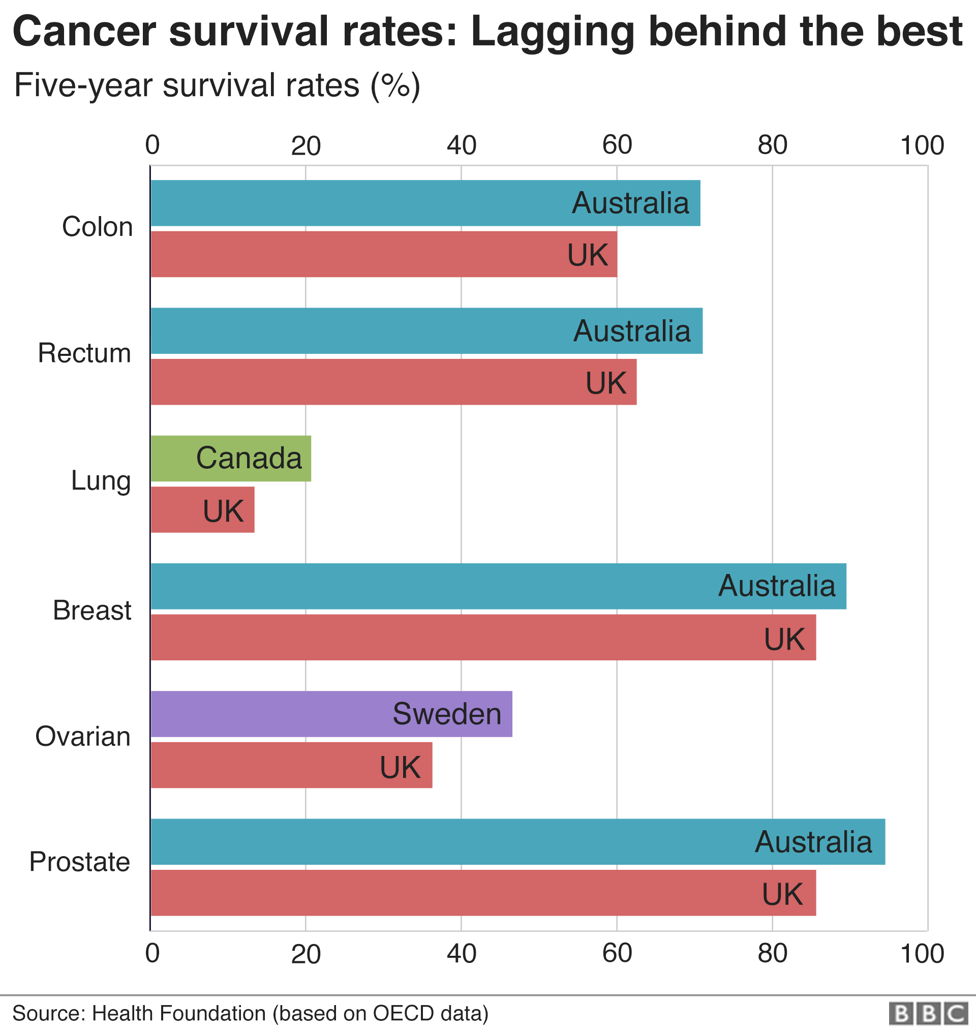 Cancer care: England still lagging behind the best - BBC News