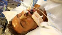 Sepsis: How good are hospitals at treating 'hidden killer'? - BBC News