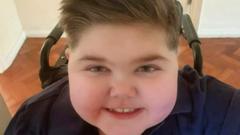 Disability: Ballet dancer Joe Powell-Main seen as 'wrong type' - BBC News