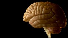 Frontal brain wrinkle linked to hallucinations - BBC News