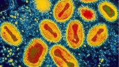 Smallpox general in US university row - BBC News
