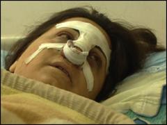 More cosmetic surgery in Iraq after drop in violence - BBC News