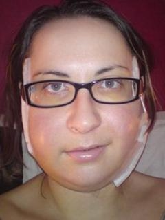 'Jaw replacement surgery ended my unbearable pain' - BBC News