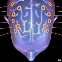 EEG brain trace 'can detect autism' - BBC News