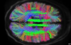 Scans reveal intricate brain wiring - BBC News