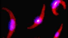 Immune children aid malaria vaccine hunt - BBC News