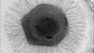 Atrapan al Megavirus, el más grande conocido hasta ahora - BBC News Mundo