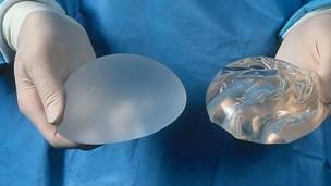 ¿Qué ocurre con las prótesis e implantes después de morir? - BBC News Mundo