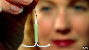 Contraceptive coil raises hope of delaying womb cancer - BBC News