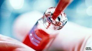 Down's syndrome DNA blood test 'better screening offer' - BBC News