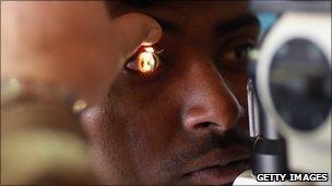 Cardiff expert's ethnic eye test 'catastrophe' warning - BBC News