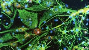 Breakthrough in delivering drugs to the brain - BBC News