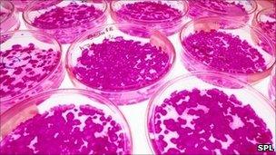 Ban on stem-cell patents 'wrong' - BBC News