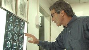 Controversial cyborg rat tests target brain treatments - BBC News