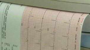 Cry charity's Penzance heart screening for young people - BBC News