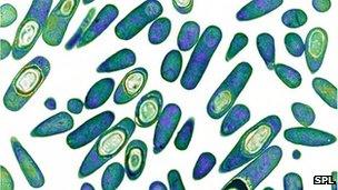 Three die after catching new C. diff strain in Scotland - BBC News