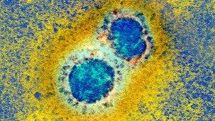 Bat virus clues to origins of Sars - BBC News