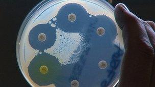 Reservoir bugs - Dundee students develop 'cure' using E.coli - BBC News