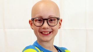Alopecia: 'It takes a bit more courage to get on stage' - BBC News